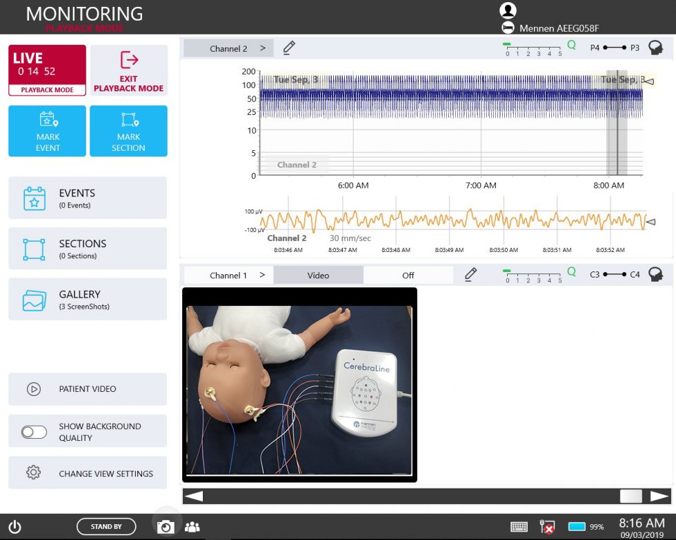 aEEG | Mennen Medical